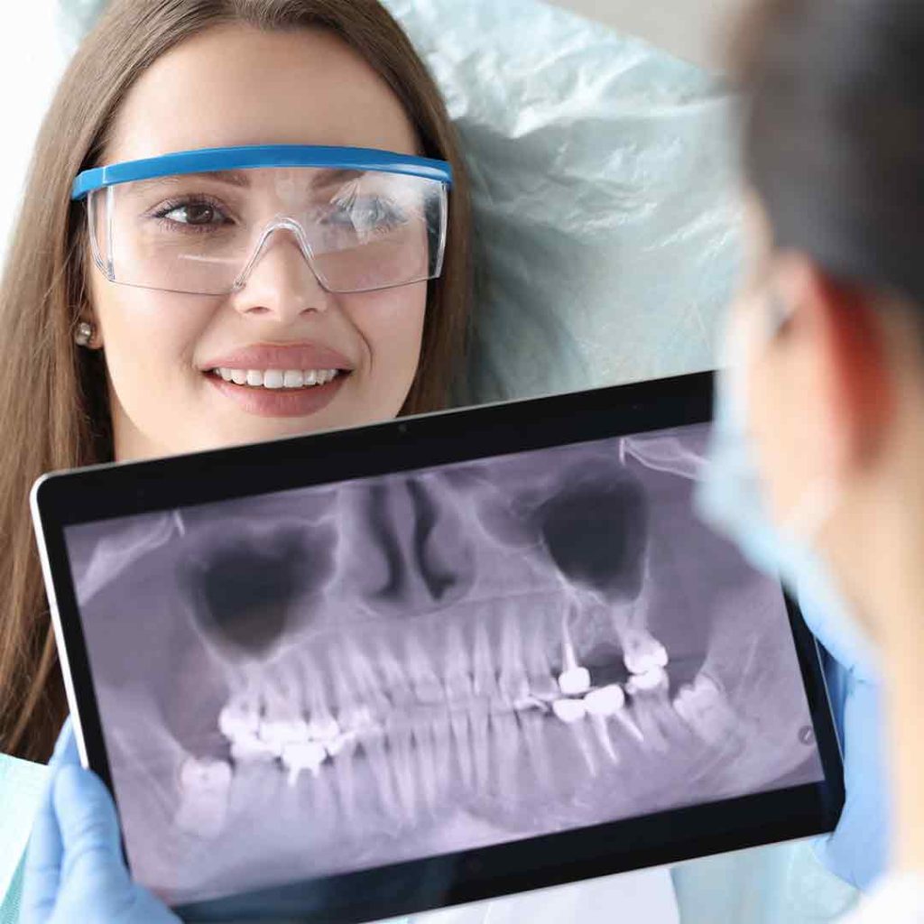Dental X-Rays Toronto - Pape Dental Centre