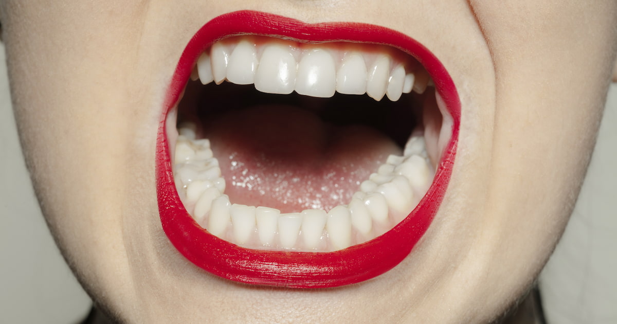 Lower Jaw Dental Implants Guide To Benefits And Procedure 9376